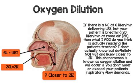 High Flow Nasal Cannula HFNC Part How It Works REBEL EM Emergency Medicine Blog