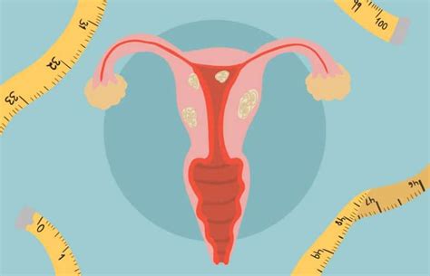 What Could Trigger Enlarged Uterus 12 Possible Causes Optinghealth