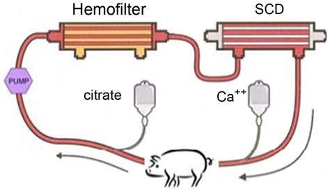 Extracorporeal Circuit With Scd Download Scientific Diagram