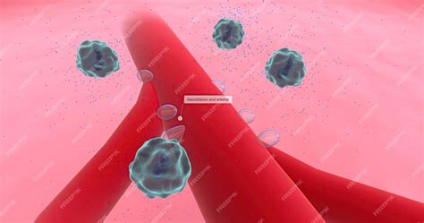 Premium Photo Anaphylaxis Histamine Release And Vascular Edema