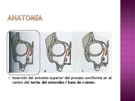 Apfisis Unciforme Pequea Lmina Sea Cubierta Por Mucosa