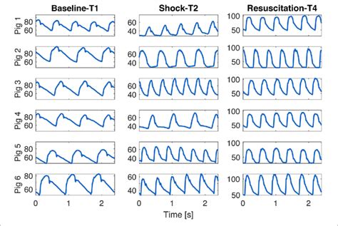 Example Of Few Beats Extracted From Aortic Waveform At Each Time