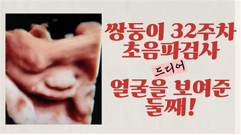 아들 쌍둥이 임신 32주차 초음파검사 둘째 얼굴 Youtube