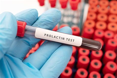 Is It Worth It To Get A Prolactin Level Test Health And Wellness