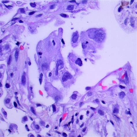 Histopathelogical Instance Segmentation Dataset And Pre Trained Model By Cell Segmentation
