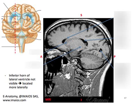 Diagram Of Week 5 7 Quizlet