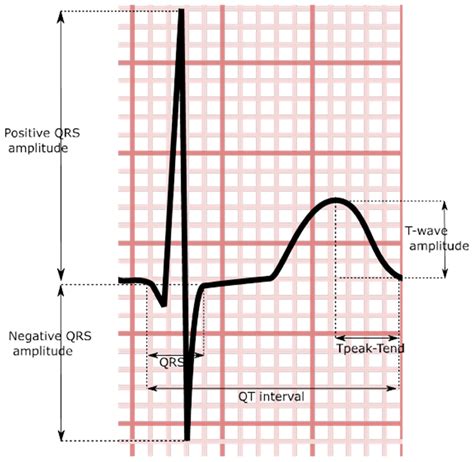 T Wave Amplitude