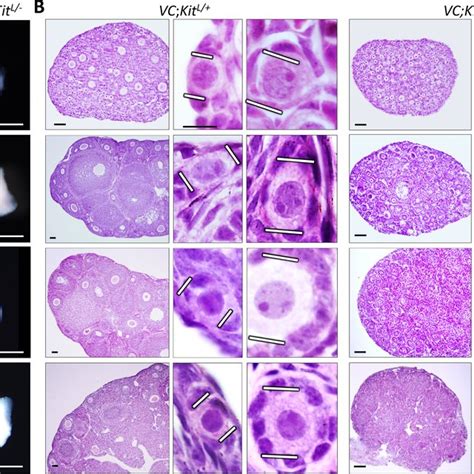 Quantitative Analyses Of Oocyte Phenotypes Following Kit Inactivation Download Scientific