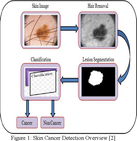 Figure From A Method For Melanoma Skin Cancer Detection Using Dermoscopy Images Semantic Scholar