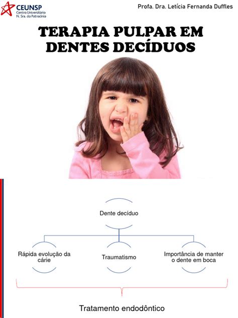 Terapia Pulpar Em Dentes Decíduos Download Grátis Pdf Especialidades Médicas