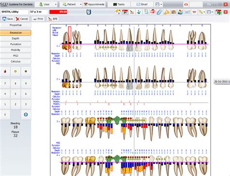 Periodontal Charting Software Features
