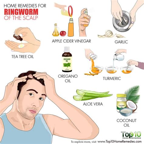 How To Get Rid Of Ringworm On Scalp Home Remedies At Emily Jenkins Blog