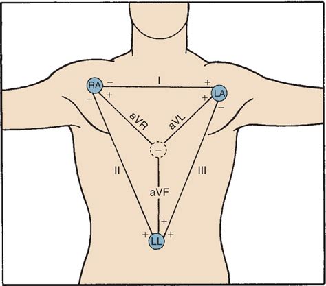 Electrocardiographic Monitoring Clinical Tree