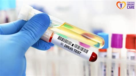 Understanding Drug Testing In Forensic Toxicology Centers Urgent Care