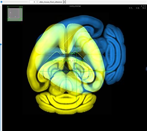 Export Coordinates From Qupath To Brainglobe Usage And Issues Imagesc Forum