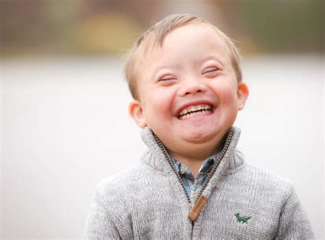 Синдром Дауна откуда появляются «солнечные дети