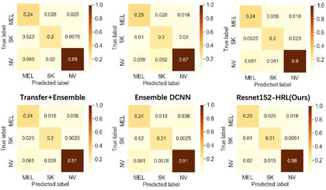 Confusion Matrixes Of Different Methods On Isic 2017 Dataset Download