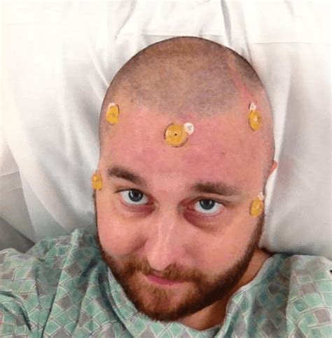 Man With Skin Cancer Chronicles His Journey In This Heart Wrenching