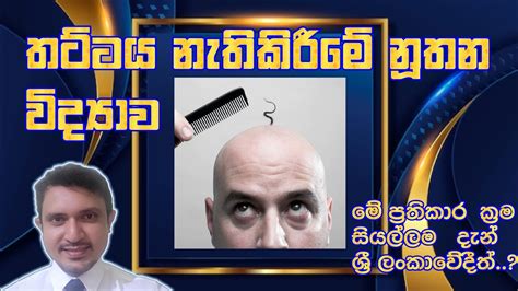 පිරිමින්ගේ හිස කෙස් යාම නවත්වන නූතන ප්‍රතිකාර 8 Male Hair Loss Treatments Healthyskinlk