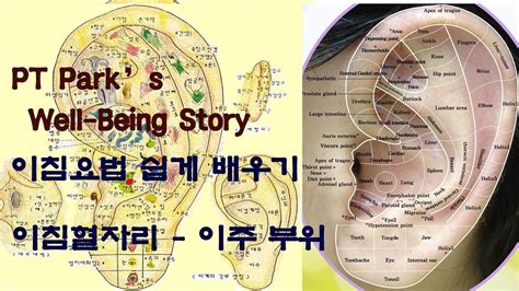 이침활석요법강좌초급6강 이침요법 각부분의 명칭 이주 Youtube