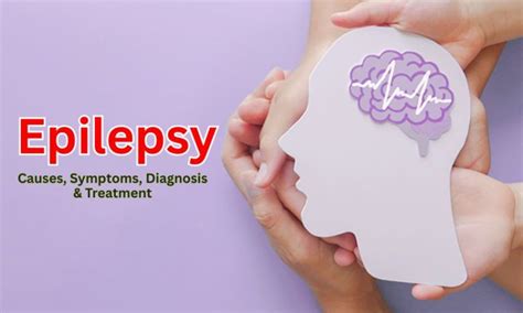 Epilepsy Causes Symptoms Diagnosis And Treatment