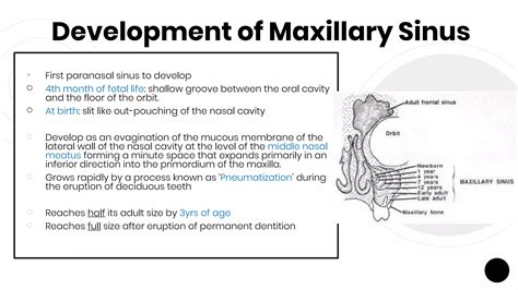 Maxillary Sinus Imaging Pptx