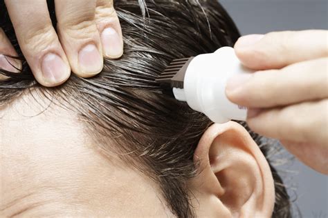 Lead Acetate Hair Dye Captions Graphic