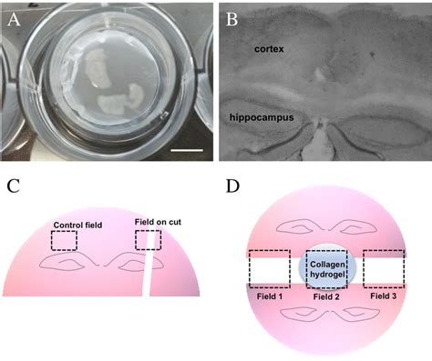 Organotypic Half Brain Slices Of 10 Day Old Postnatal Mice Were Download Scientific Diagram