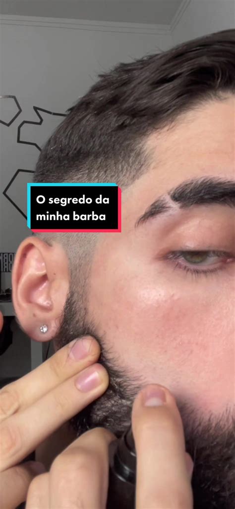 Barba Irregular Antes E Depois Alopecia Na Barba O Que Você Deve