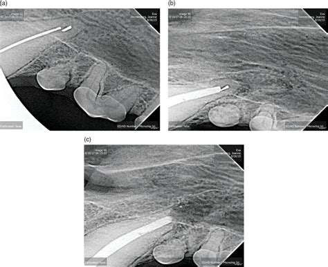 Advanced Endodontic Therapy Veterian Key