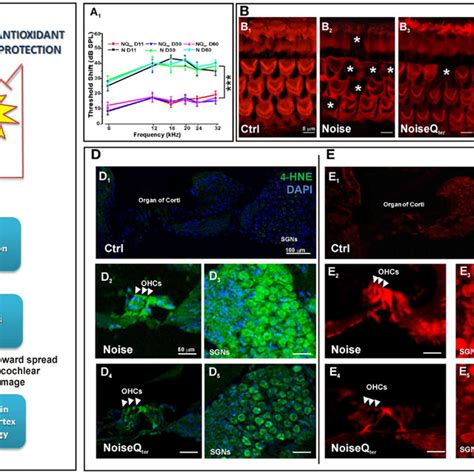 Cortical Morphological Modifications Induced By Noise Induced Cochlear Download Scientific