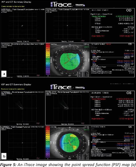 Figure 1 From Itrace A Ray Tracing Aberrometer Semantic Scholar