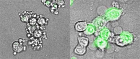 Gasdermin E：一种可能具有广泛影响力的癌症免疫疗法的新方法 Bob 官方