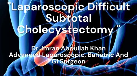 Laparoscopic Subtotal Cholecystectomy Difficult Cholecystectomy Dr Imran Abdullah Khan