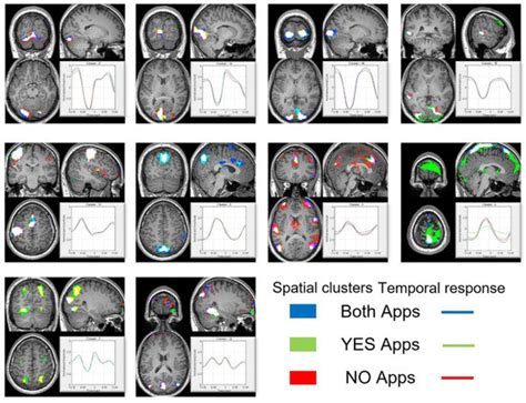 Visualization Of The Dynamic Brain Activation Pattern During A Decision Making Task