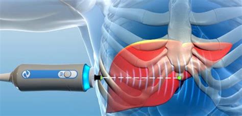 Fibroscan Jivan Hospital