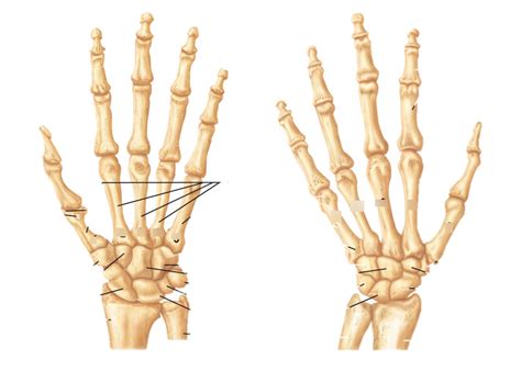 Carpals Metacarpals And Digits Diagram Quizlet