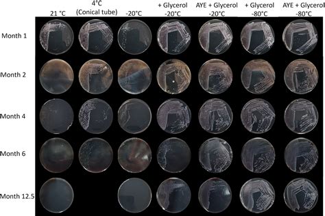 Detection Of Diverse Sequence Types Of Legionella Pneumophila By