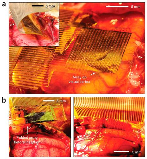 A Flexible High Density Active Electrode Arrays Composed Of Download Scientific Diagram