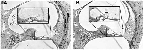 A Mid Modiolar Plastic Section Of The Basal Cochlear Turn Is Shown By