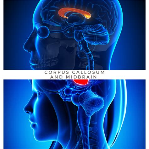 Corpus Callosum Anatomy