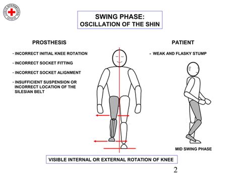 Transfemoral Gait Deviations Ppt