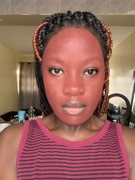 Facial Skin Condition Dataset Unidata Pro