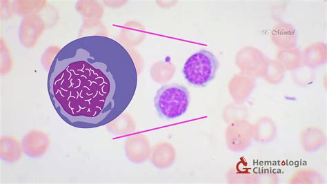 Eritroblastos Son Células Hematología Clínica Facebook