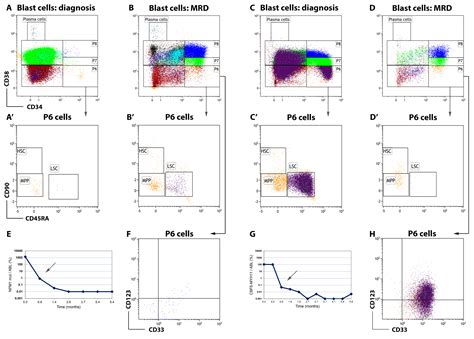 Flow Cytometry To Estimate Leukemia Stem Cells In Primary Acute Myeloid Leukemia And In Patient