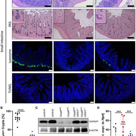 Stat1 Signaling Attenuates Necroptosis And Partially Restores Paneth