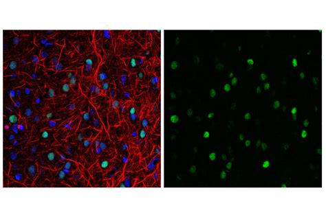 C Fos 9f6 Rabbit Mab Cst 优宁维 Univ 商城