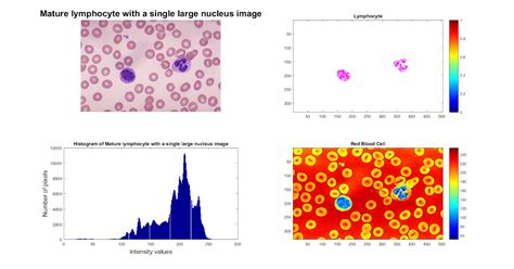 Biomedical Signal And Image Processing Projects Using Matlab And Labview Tools Matlab Code To