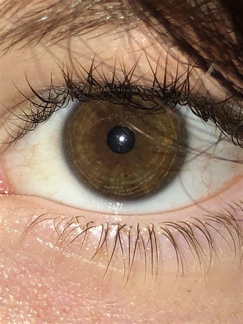 Central Heterochromia Brown Eyes Why Your Eye Color Isnt Just One