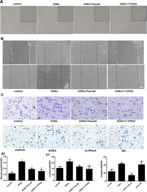 Rhoa Inhibition Decreases Age Induced Migration In Hpmc Cells A Download Scientific Diagram